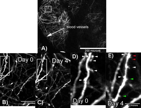 Chronic Imaging Of Mouse Visual Cortex Using A Thinned Skull Preparation