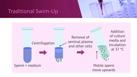 Semen Preparation Methods Principles Techniques PPTX