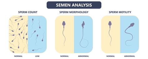 Sperm Selection Raleigh Nc