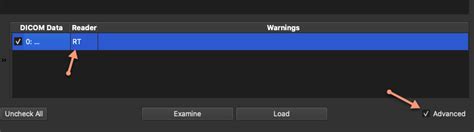 Problem Importing Rtstruct Support 3d Slicer Community