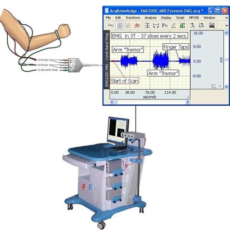 Function Chart For Capturing And Processing Myoelectric Signals Using Download Scientific