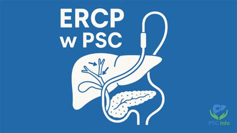 Ercp W Psc Kiedy Warto A Kiedy Unikać Wytyczne 2025 Wskazania I Powikłania Pscinfo Pl