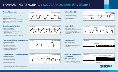 Capnography Normal And Abnormal Waveforms Poster Waveform Characteristics A B Baseline B C