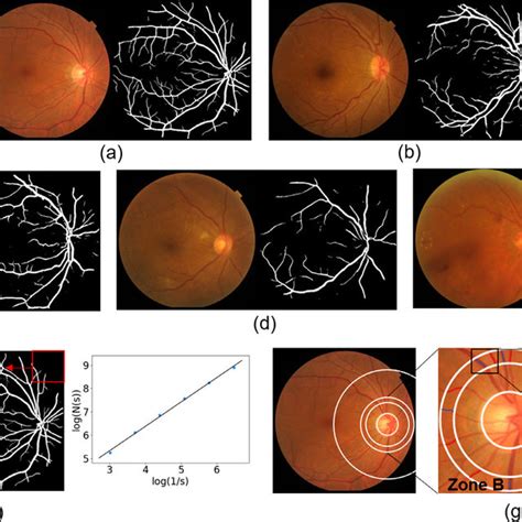 The Vessel Segmentation Results Of 2 Example Fundus Images The First Download Scientific