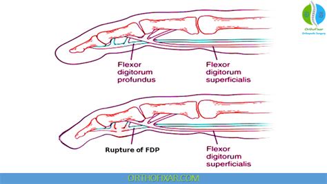 Flexor Digitorum Profundus Function