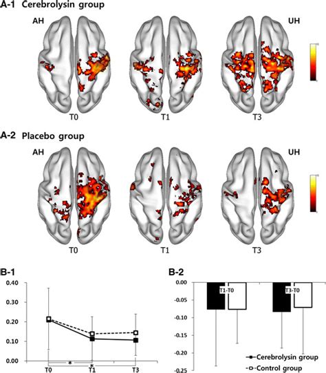 Resting State Of The Sensorimotor Network As Shown By The Resting State Download Scientific