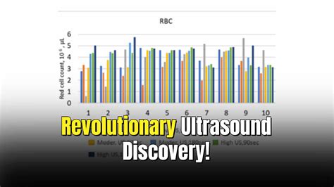 Effective Noninvasive Hemodynamic Theory