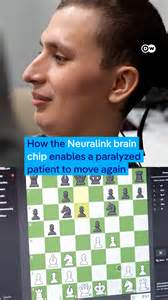How The Neuralink Brain Chip Enables A Paralyzed Patient To Move Again