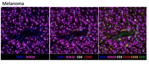 Multiplex Immunofluorescence Cio Tissue Biomarker Lab