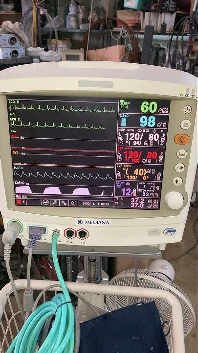 의료기기 환자관찰 종합모니터 Youtube