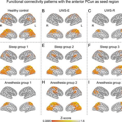 Functional Connectivity Of The Anterior Precuneus Average Functional