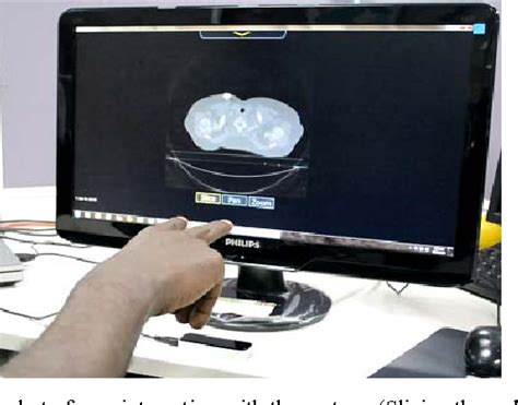 Figure 8 From A Touchless Interface For Interventional Radiology