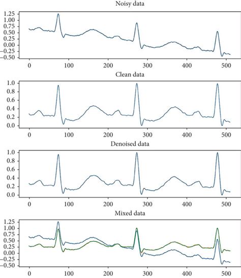 The Effect Of Removing Three Types Of Single Noise In The Ecg Signal Download Scientific