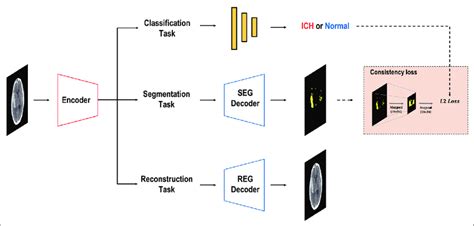 A Typical Case Of Hemorrhage Detection With Multi Task Learning In Head