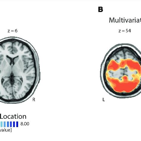 Topographies Of Uni And Multivariate Fmri Analysis Results A The Download Scientific