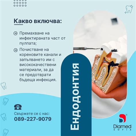 Diamed Sofia On Linkedin 🦷 Защитете здравето на зъбите си с ендодонтични грижи от Диамед София 🌟…