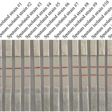 Specificity Confirmation Image Shows Rpa Lfs Results Of Different