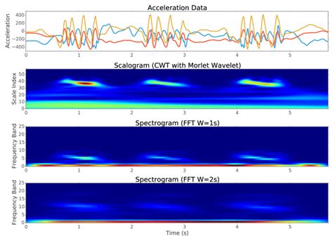 Time Frequency Power Spectrum Of An Acceleration Signal I E Raw