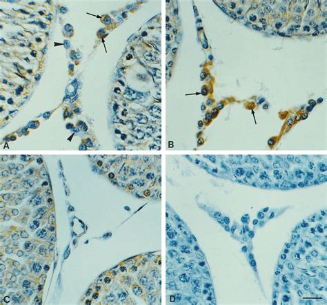 Fasr Immunohistochemistry In Interstitial Spaces Of Rat Testis After