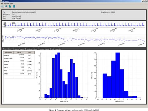 Figure 1 From Nonlinear Analysis Of Heart Rate Variability In Type 2
