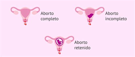 Textos Argumentativos Sobre Aborto Librain