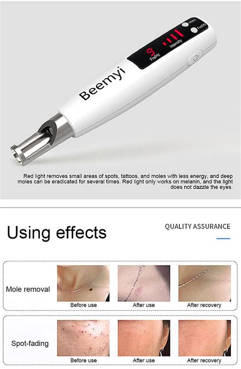 가정용 레이저 문신 제거 Picosecond Pen 의 고품질 가정용 레이저 문신 제거