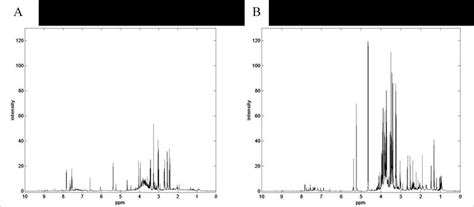 Representative 600 Mhz 1 H Nmr Dosed Rat Urine Spectra Download