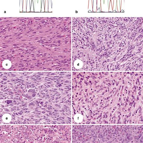 Example Of Direct Sequencing Of A KIT Exon And B KIT Exon Download Scientific