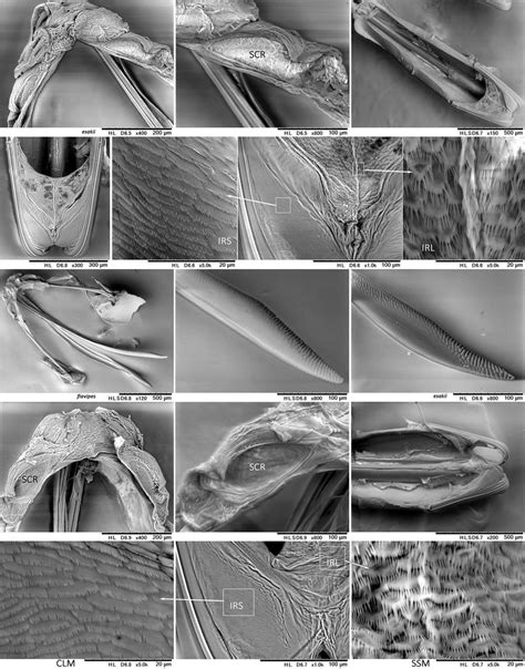 Scanning Electron Micrographs Of The Female Genitalia For Pseudophylus Download Scientific