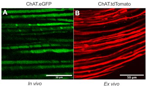 Expanding The Toolkit For In Vivo Imaging Of Axonal Transport Protocol