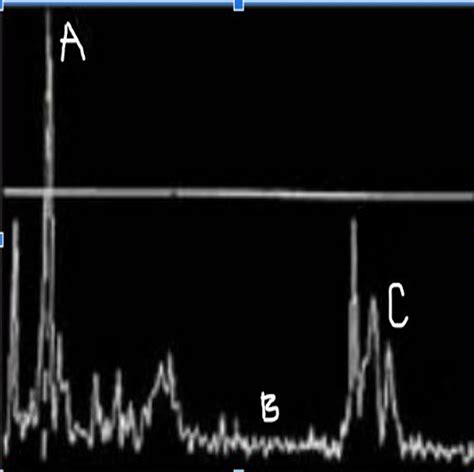 Comprehensive Overview Of Pulse Echo Range Equation Scanning Modes And Transducers In Medical