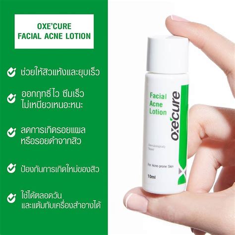 Oxecure Facial Acne Lotion 10ml Shopee Malaysia
