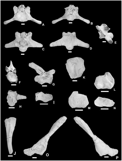 Second Sacral Vertebra Mtm Gyn121 In Anterior A Posterior B