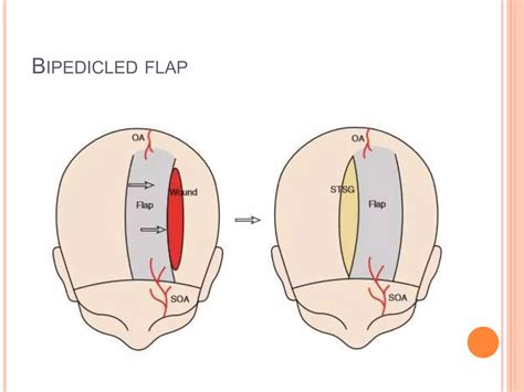 Scalp Defects Pptx