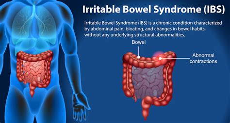 What Is The Difference Between Irritable Bowel Syndrome Ibs And Inflammatory Bowel Disease
