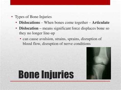 Ppt Chapter 4 Notes Powerpoint Presentation Free Download Id 1873387