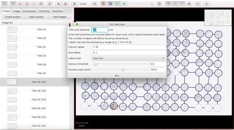 Tma Cd Analysis Qupath Qupath Wiki Github
