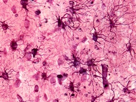 How Astrocytes May Be Able To Help With Brain Repair Best Health