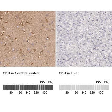 Anti Ckb Antibody Produced In Rabbit