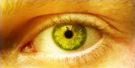 Элэг хордсон үед хүний биед илрэх 6 шинж тэмдэг Танд эдгээр зүйлс ажиглагдвал анхааралгүй