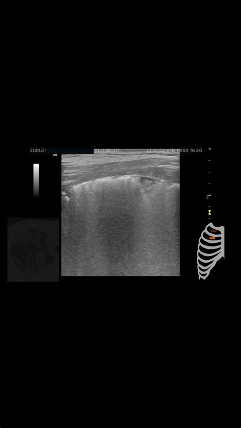 Abhilash Koratala Nephropocus • Instagram Photos And Videos