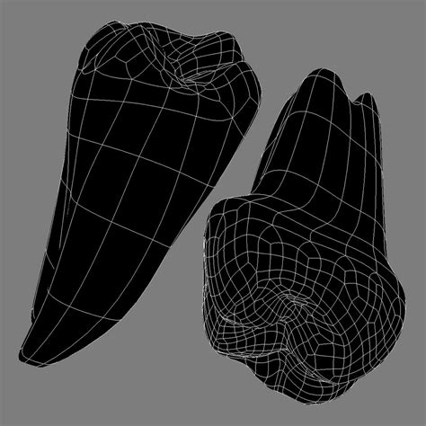 Max Teeth Molars Wisdoms