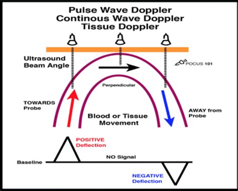 Spectral Doppler Flashcards Quizlet
