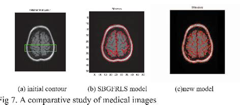 Figure 1 From Level Set Method For Image Segmentation Model Based On Improved Signed Pressure