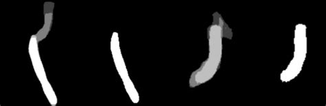 Figure 6 From Deep Learning Pipeline For Chromosome Segmentation