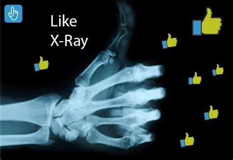 All The Secrets Of X Ray Search