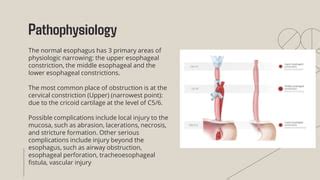 Foreign Body Obstruction Esophagus Pptx