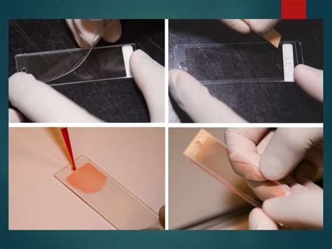 Presentation On Protein Array Pptx Biotech And Biomedical Industry