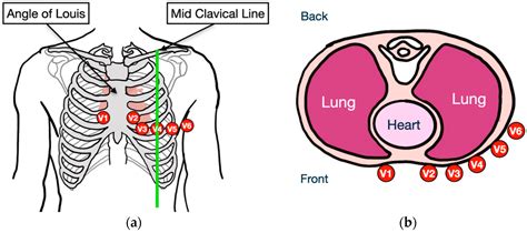 Ekg Electrode Placement Ecg Lead Placement Stock Illustrations 9