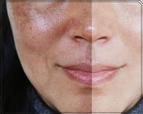 Цус тань өтгөрч бохирдсон бол дараах шинж тэмдгүүд илэрнэ “ЦАХИУР ТӨМӨР” ХХК